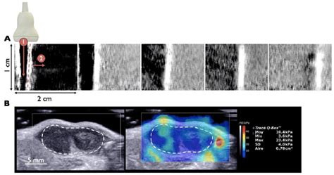 Shear Wave Propagation A A Shear Wave Is Generated By Applying Download Scientific Diagram