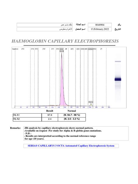 Haemoglobin Capillary Electrophoresis ملك باسم عمر 8048904 Pdf