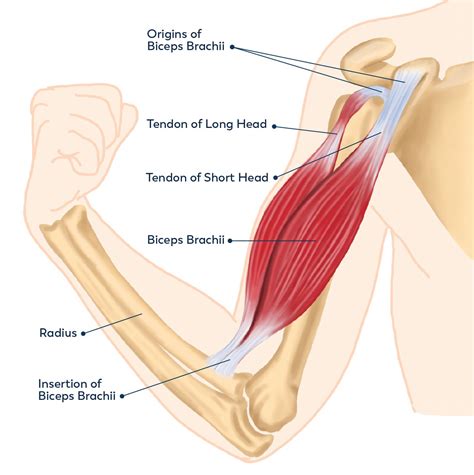 Distal Biceps Tendon Tear — Dr Jeevaka Jay Amaranath Orthopaedic Upper Limb Surgeon Sydney