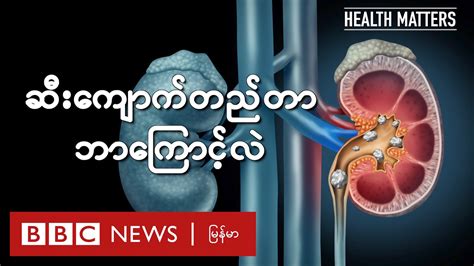 အရွယ်ရောက်ချိန် အဝလွန်မလားကို Dna စမ်းဆေးမှုဖြင့် ခန့်မှန်းနိုင် Bur Mizzima Com