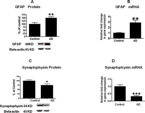 Disturbed Neurotransmitter Transporter Expression In Alzheimers Disease Brain Abstract