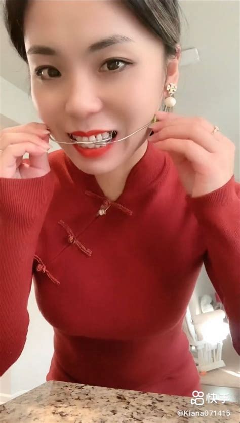 Adult Braces Headgear Future Hair Styles Pins Quick Beautiful