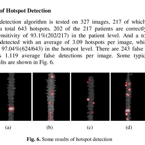 The Comparison Of Hotspot Detection Accuracy Download Table