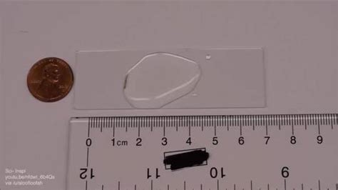 Comparing The Size Of Common Microorganisms Under The Microscope Scrolller
