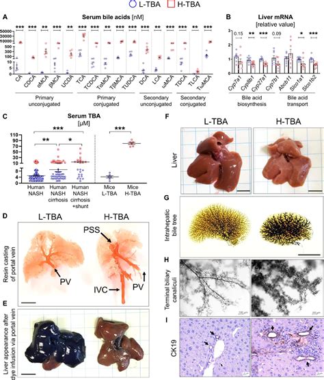 Enterohepatic Shunt Driven Cholemia Predisposes To Liver Cancer Pmc