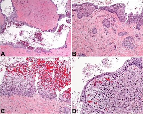 Dentigerous Cyst And Periapical Cyst A This Dc At Low Power Download Scientific Diagram