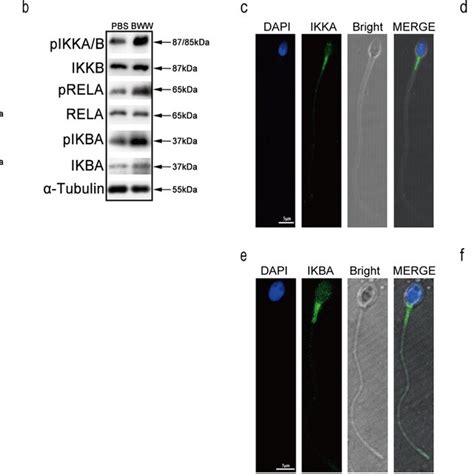 Expression And Localization Of Canonical Nf κb Proteins In Human Download Scientific Diagram