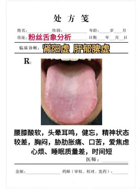 舌苔透露健康秘密这些症状你是否也有