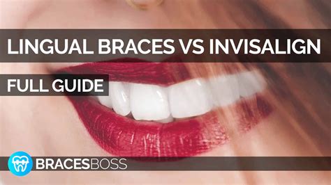 Lingual Braces Vs Invisalign Full Pro Guide 2025 Bracesboss
