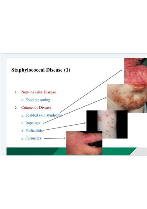 Summary Staphylococcal Disease Medicine Stuvia Us