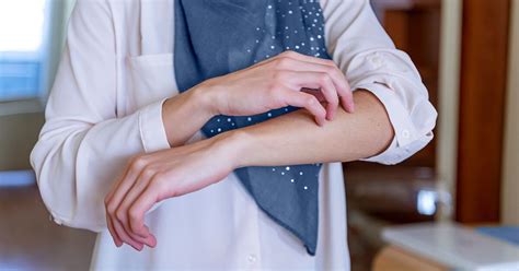 Anxiety And Itching Why It Happens And What To Do