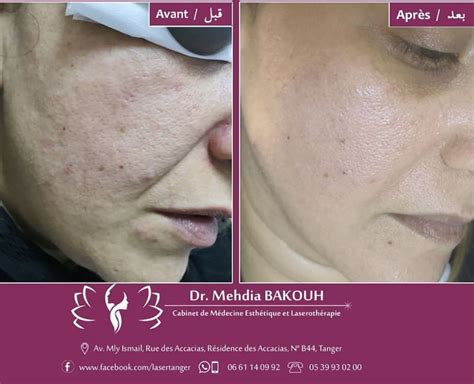 Instagram Photo By Dr Mehdia Bakouh • Aug 27 2023 At 241 Pm