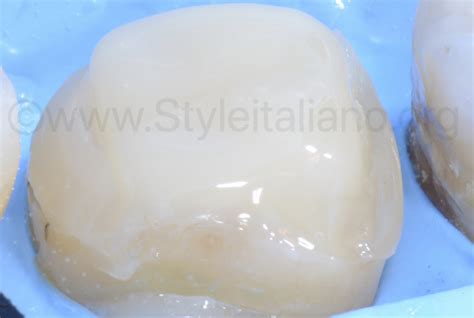 The Combo Cementation A Dual Consistency Composite Approach