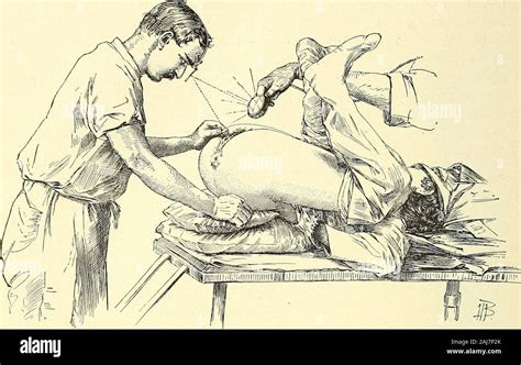 Operative Gynecology Ion May Be Made And The Speculumintroduced Without Much Discomfort