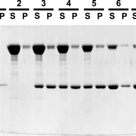 Actin Binding Filamentous Rabbit Skeletal Muscle Actin Was Incubated