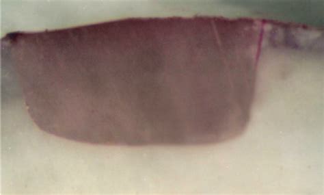 Section Showing Score 1 Microleakage Download Scientific Diagram