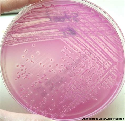 Citrobacter Antibiotic Sensitivity