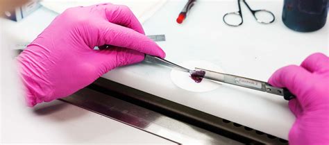 The Reshaped World Of Digital And Computational Pathology