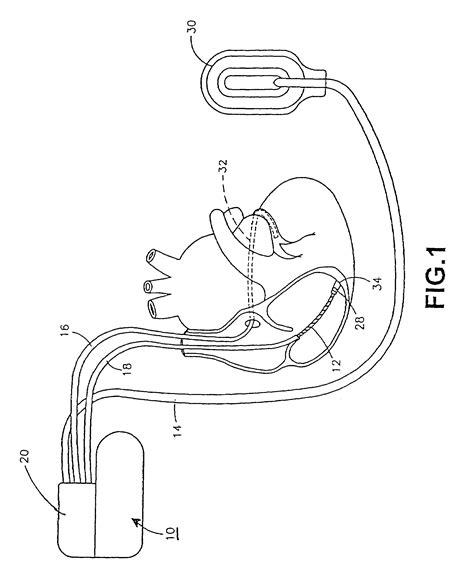 Capacitor Terminals Patented Technology Retrieval Search Results Eureka Patsnap
