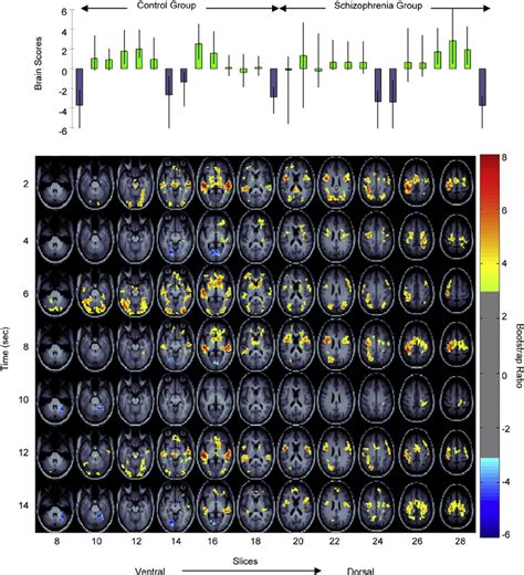 Results From The Non Rotated Task Pls Analysis Contrasting Modulation Download Scientific