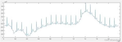 【20220114】【信号处理】什么是基线漂移趋势项？如何消除？ Csdn博客