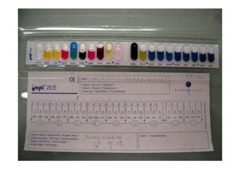 Api 20e Color Chart Ponasa