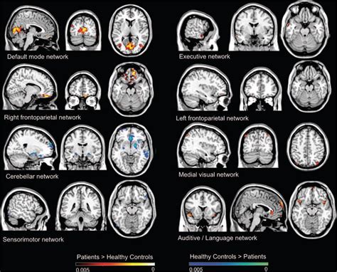 Resting State Networks Which Showed Between Group Functional Download Scientific Diagram