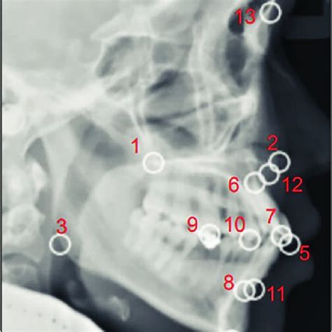 Training Loss Of The Object Detection Model With The Graph Decreasing