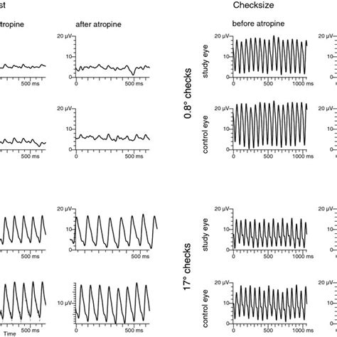 Representative Sample Traces Of One Participant Curves Represent The
