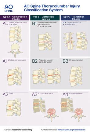AO Spine Classification Of Thoracolumbar Injuries Radiology Reference