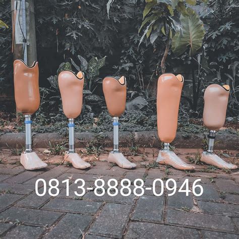 Jasa Pembuatan Kaki Palsu Bawah Lutut Dan Sepatu Ortopedi Di Bekasi Tribun Jualbeli