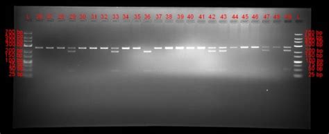 Figure 2 From Investigation Of Ppar Alpha Gene Polymorphism In Females