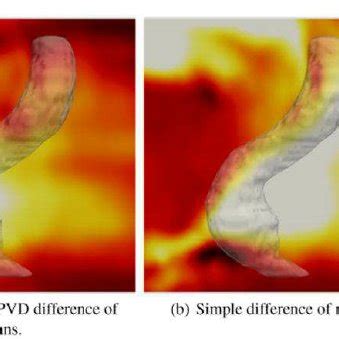 Histograms Of The Test Statistics Used In The T Test Download Scientific Diagram