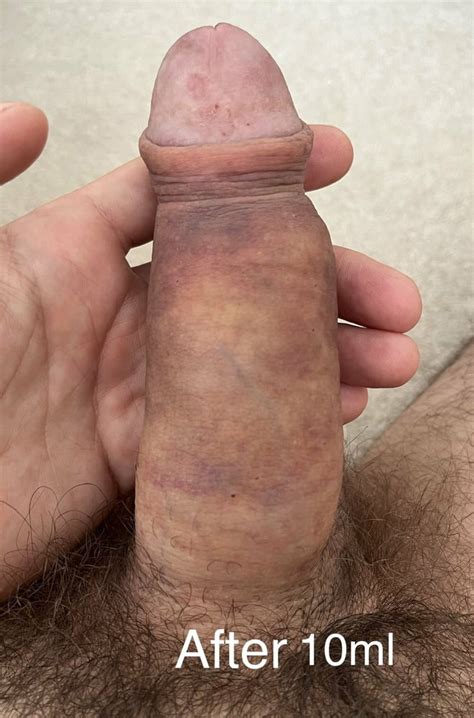 Modified Cock 19 Pics Xhamster