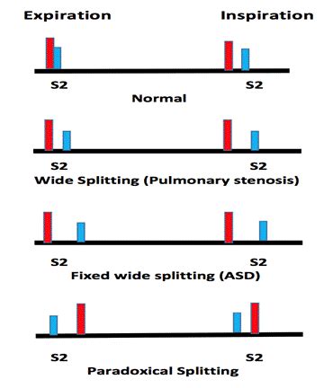 Heart Sounds And Murmurs