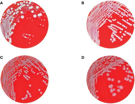 Klebsiella Pneumoniae Gram Stain Morphology
