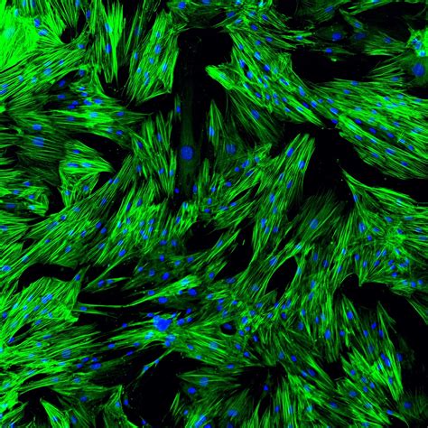 Diversity Matters Fibroblast Heterogeneity In Pulmonary Fibrosis