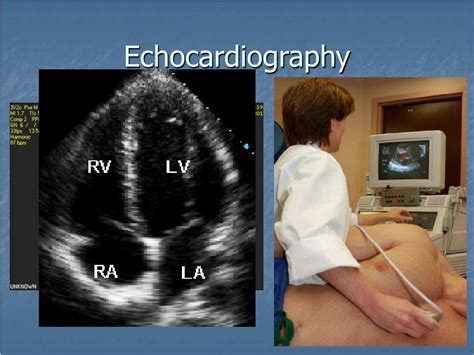 PPT The Heart PowerPoint Presentation Free Download ID 6706827