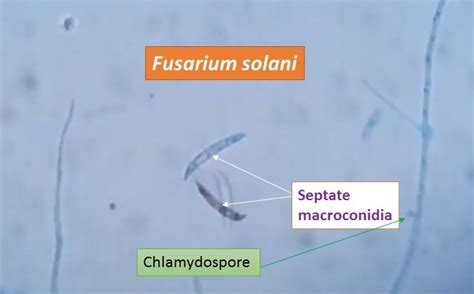 Fusarium Solani In Lpcb Mount Introduction And Lpcb Preparation In