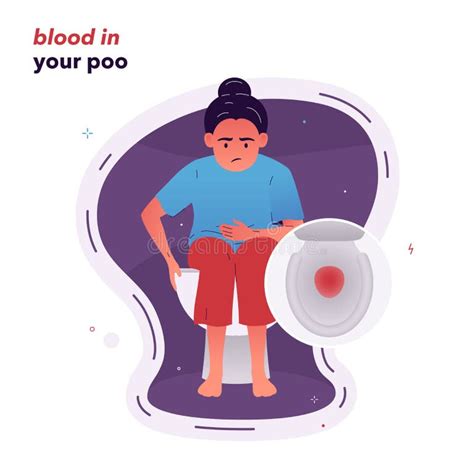 Symptoms Hemorrhoids Stock Illustrations 45 Symptoms Hemorrhoids