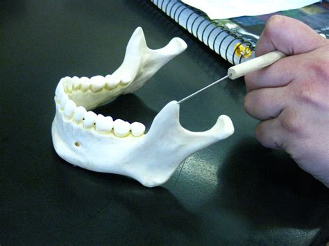 Boned Human Skull Coronoid Process Of Mandible
