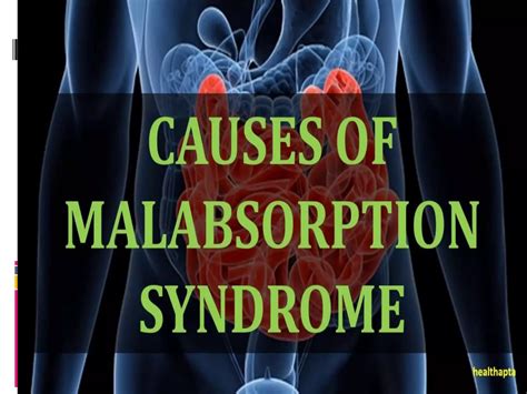 Malabsorption Syndrome Pptx
