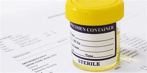 Leukocitna esteraza i povišeni leukociti u urinu uzroci simptomi i liječenje Kreni zdravo