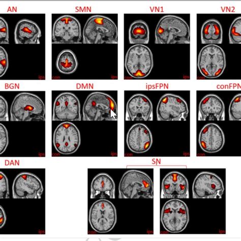 The Spatial Maps Of Ten Resting State Networks Abbreviations An Download Scientific Diagram