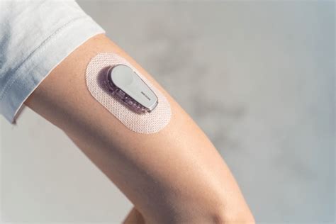 Dexcom Continuous Glucose Monitoring Over 78 Royalty Free Licensable