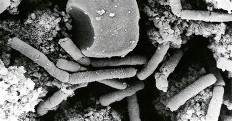 Anthrax 84 Cdc Workers Might Have Been Exposed To Pathogen Los Angeles Times