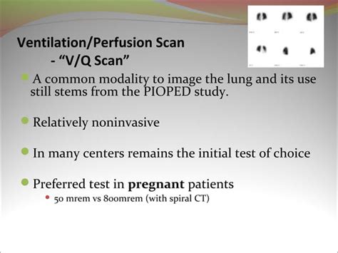 VQ Scan Of Lung PPT