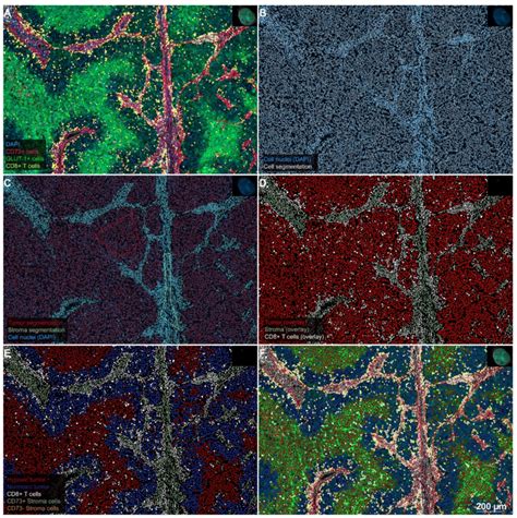 Stepwise Procedure For The Analysis Of The Number And Spatial Context Download Scientific