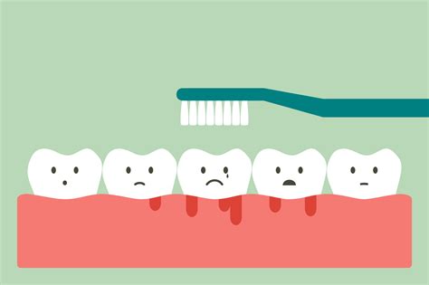 What Causes Sore Teeth And Bleeding Gums At Dorothy Hood Blog
