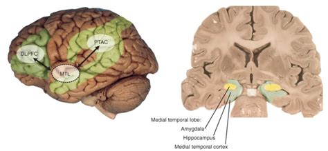 Memory Diagram Quizlet